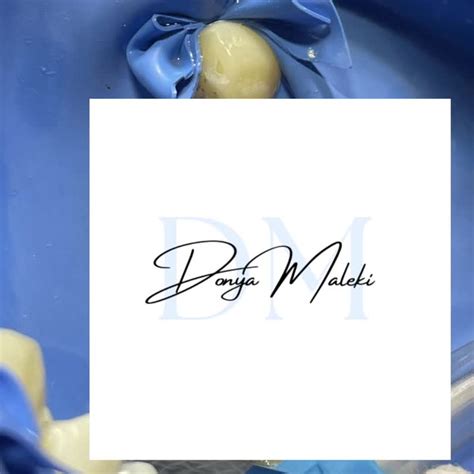 🦷 Maxillary Right Second Premolar As The First Premolar Was Missing