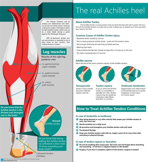 Achilles Tendon And Treatment Of Achilles Tendon Rupture