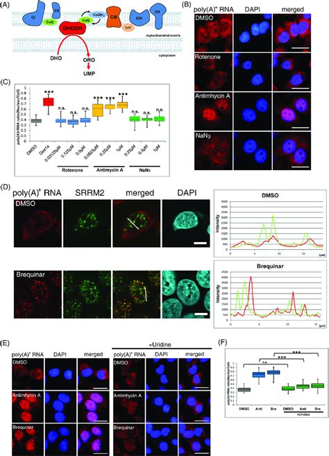 De Novo Pyrimidine Synthesis Pathway Perturbs Poly A Rna Metabolism Download Scientific