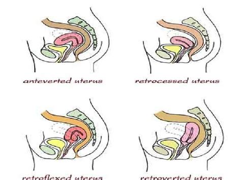 Penis In Vagina PIV Sex Fumbling For The Fornices R Sex
