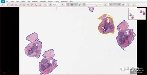 [数字病理]使用qupath检测组织（机翻版） 知乎