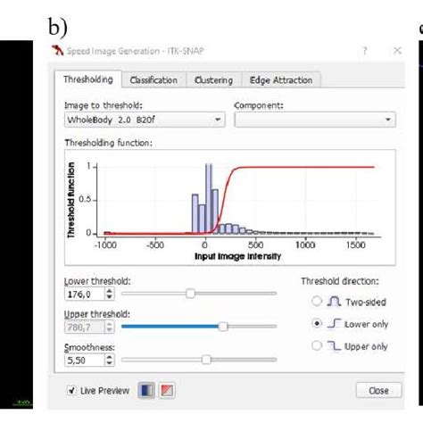 The 3d Segmentation Progression In Itk Snap A Assimilated Image Data