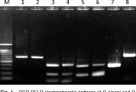 Figure 1 From Development Of A Pcr Rflp Method For Differentiation Of Perkinsus Olseni And P