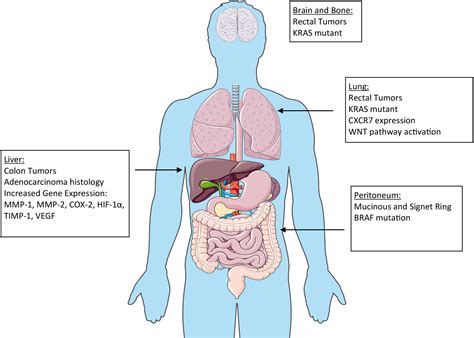 Integrated Omics Of Metastatic Colorectal Cancer Milerh