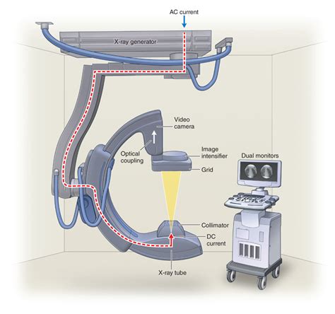 Schematic Diagram X Ray Machine