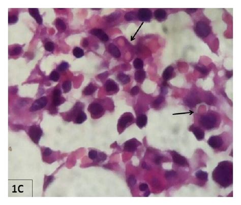 Paraffin Embedded Decalcified Bone Marrow Trephine Biopsy Sections From Download Scientific