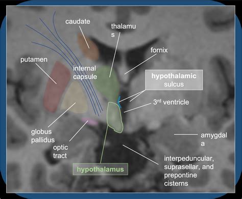 Hypothalamus Ht🧵 The Control Center Of Circadian Rhythm Fatigue
