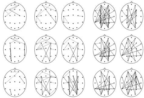 Changes In The EEG CCs At Different Stages Of Different Functional Download Scientific Diagram