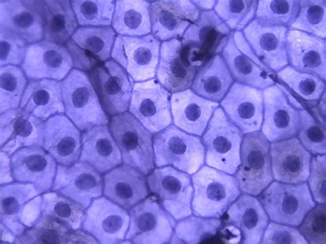 Solved Is This Adipose Tissue Chegg