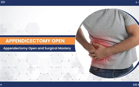 A Comprehensive Guide To Appendectomy Open And Appendicitis Recovery Wellness Hospitals