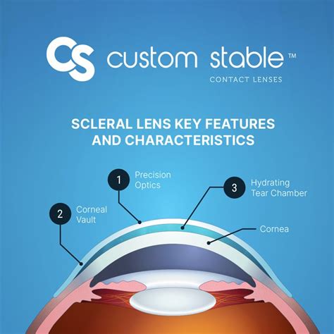 Specialty Contact Lenses