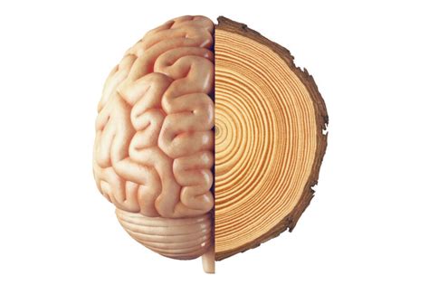 usc developed ai powered analysis reflects risk of cognitive decline