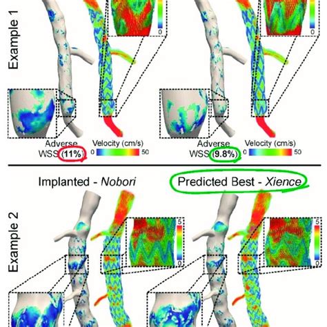 Cfd Simulations Showing The Amount Of Adverse Wss And Near Wall Download Scientific Diagram