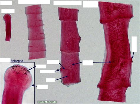 Tapeworm Diagram Quizlet