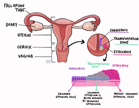 Pap Ascus Là Gì Giải Mã Kết Quả Xét Nghiệm Pap Smear Và Cách Xử Lý
