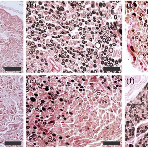 Osmium Staining For Myelinated Axons In The Implanted Conduits Osmium