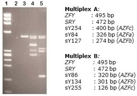 Polymorphic Rearrangements Of Human Chromosome 9 And Male Infertility