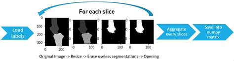 GitHub Brendan0403 BonesSegmentation Bones Segmentation By Deep Learning