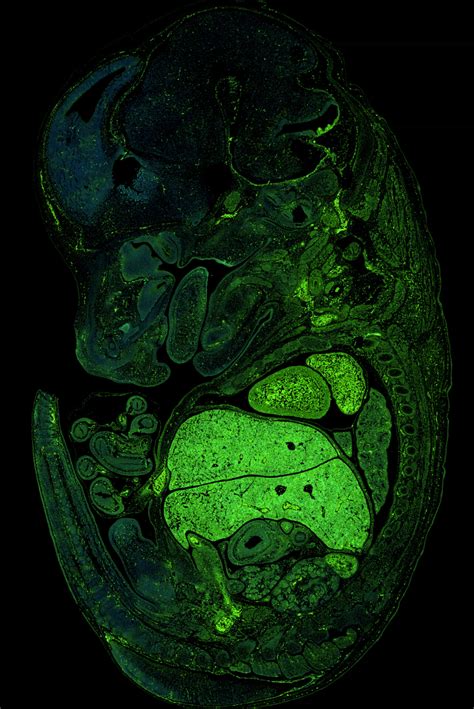 Mouse Embryo Ffpe Section E14 5 Labeled With Syncoilin Antibody Bicell Blue