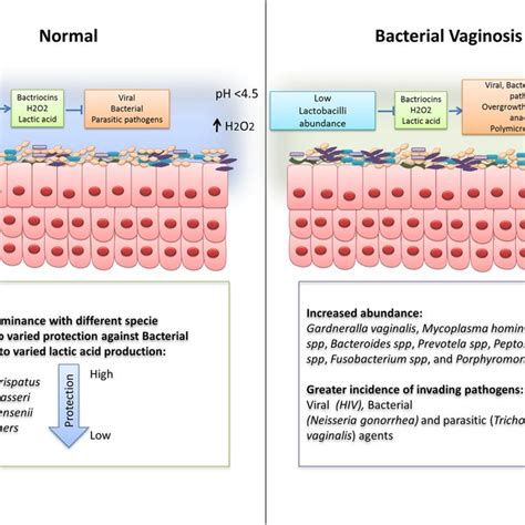 Normal Vaginal Flora Vs Bacterial Vaginosis Normal Vaginal Microflora