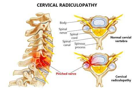 Cervical Spinal Nerves Diagram