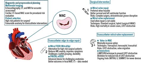 Mitral Annular Calcification In Interventional Cardiology Address All Fears Asiaintervention