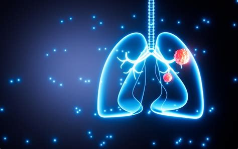 Premium Photo Human Lung Tumor Human Lung Cancer 3d Rendering