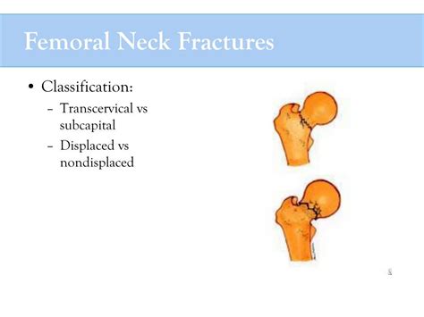 Ppt Lower Extremity Xray Rounds Powerpoint Presentation Free Download Id 5562906
