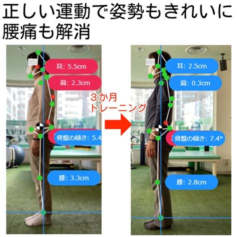 身体の変革を実感 60代女性の姿勢改善事例｜姿勢の改善・肩こり・腰痛の解消 ブログ 札幌でリハビリならリハビリジム プライズネス