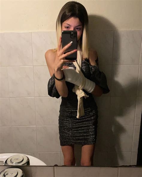 Gipsverbandde Badselfies