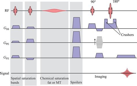 Inversion Recovery Spin Echo Pulse Sequence