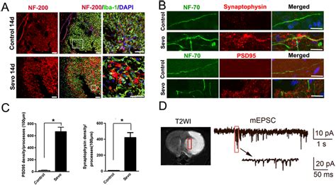 Sevoflurane Preconditioning Enhanced Structural And Functional Recovery Download Scientific