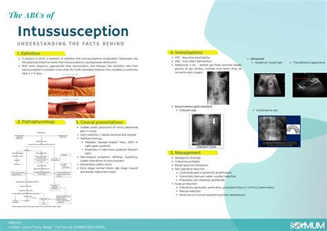 Abcs Of Intussusception Surgical Interest Group Of Monash University Malaysia