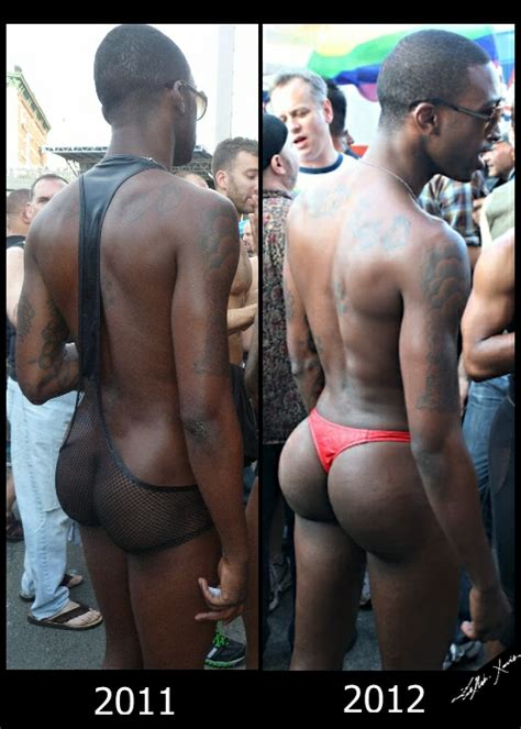 Rafael Alencar Ass Implants