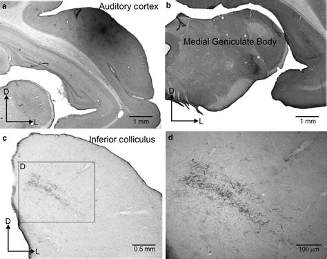 Descending Projections In The Ferret From The Auditory Cortex To The Download Scientific