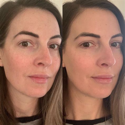 Anti Aging Skin Care Products On Instagram Um Hallo 💃 Skin Tint Spf15 You Amazing Lil