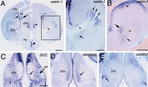 Expression Of Netrin 1 And Netrin Receptors In Relation To The Tca Download Scientific Diagram
