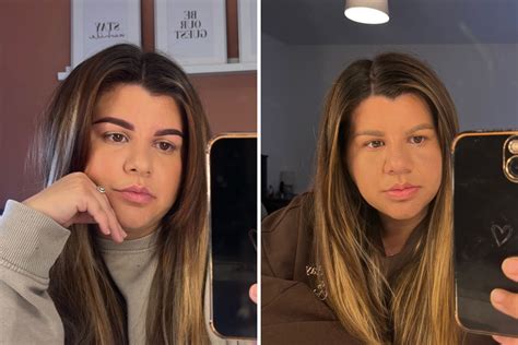 Nose Wider During Pregnancy Pregnancy Nose Problems Zuac