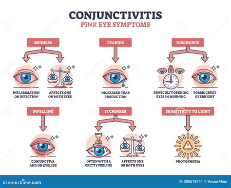 Conjunctivitis Or Pink Eye Symptoms With Medical Examples Outline