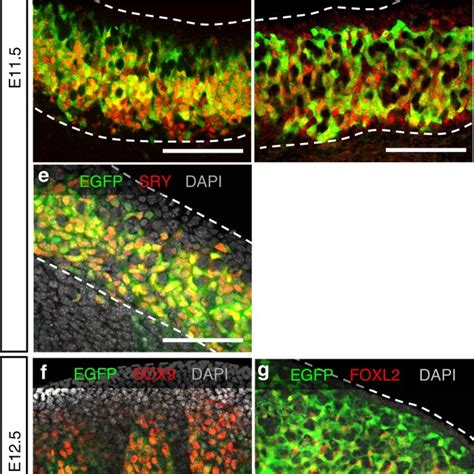 Runx1 Expression During Gonadal Differentiation In Various Vertebrates