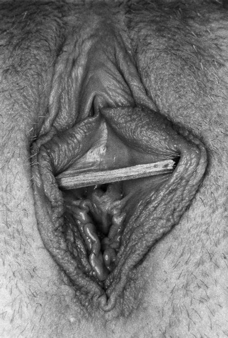 Matchstick Porn Pic Eporner Matchstick Porn Pic Eporner