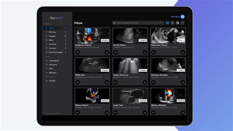 Geisinger Deploys Exos Pocus Ultrasound Workflow Solution