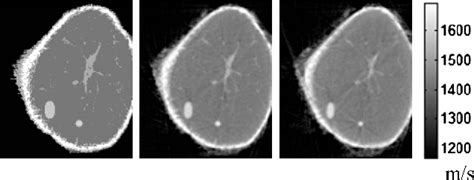 Figure 1 From Refraction Corrected Transmission Ultrasound Computed