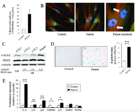Patient Derived Fibroblasts Show Senescence Related Features A Download Scientific Diagram