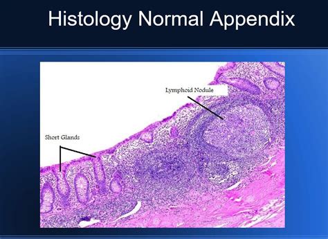 Appendix Histology