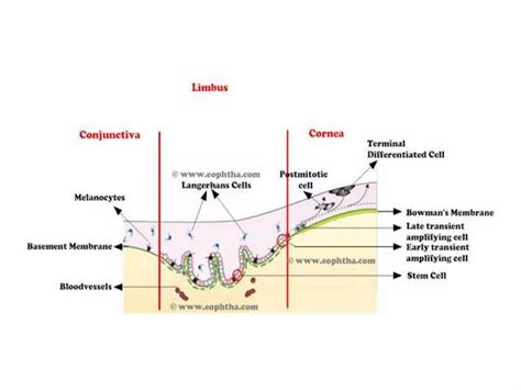 Ocular Surface Squamous Neoplasiaossn Pptx