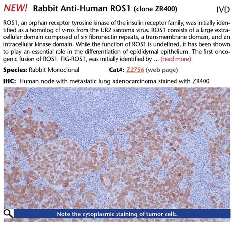 Zeta Corporation Precision Ivd Antibodies For Anatomic Pathology On