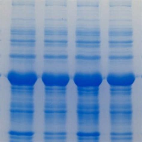 Sanger Sequencing Forward And Reverse Primers Inverted Researchgate