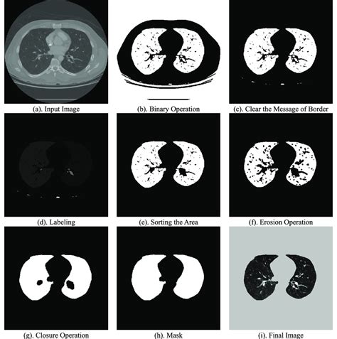 The Image Pre Processing Steps Download Scientific Diagram
