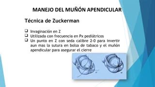 Apendicitis Seminario Tecnica Quirurgica Pptx